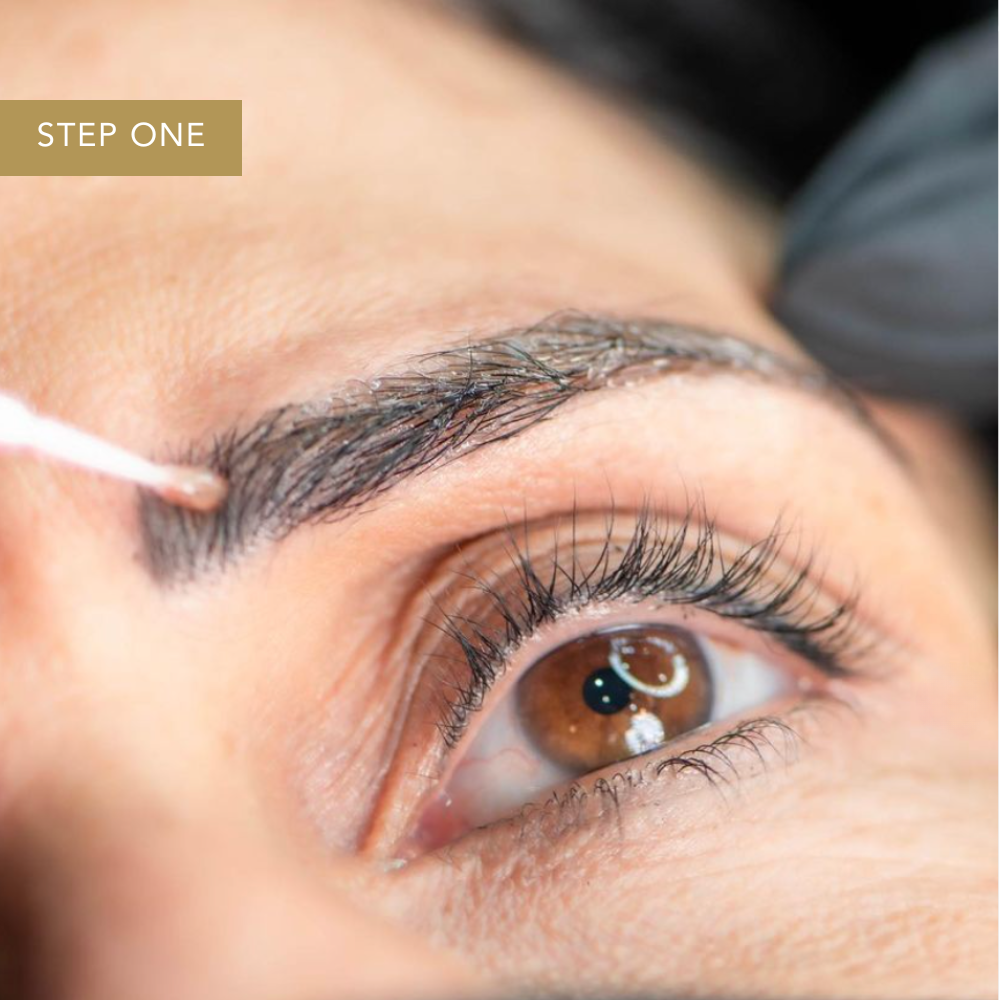 Tattoo Removal – The Brow Studio