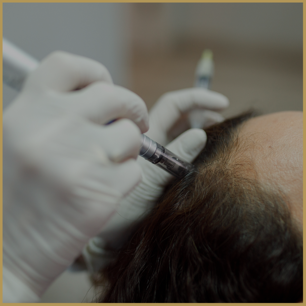 Microneedling, Hair & Brow Restoration – The Brow Studio